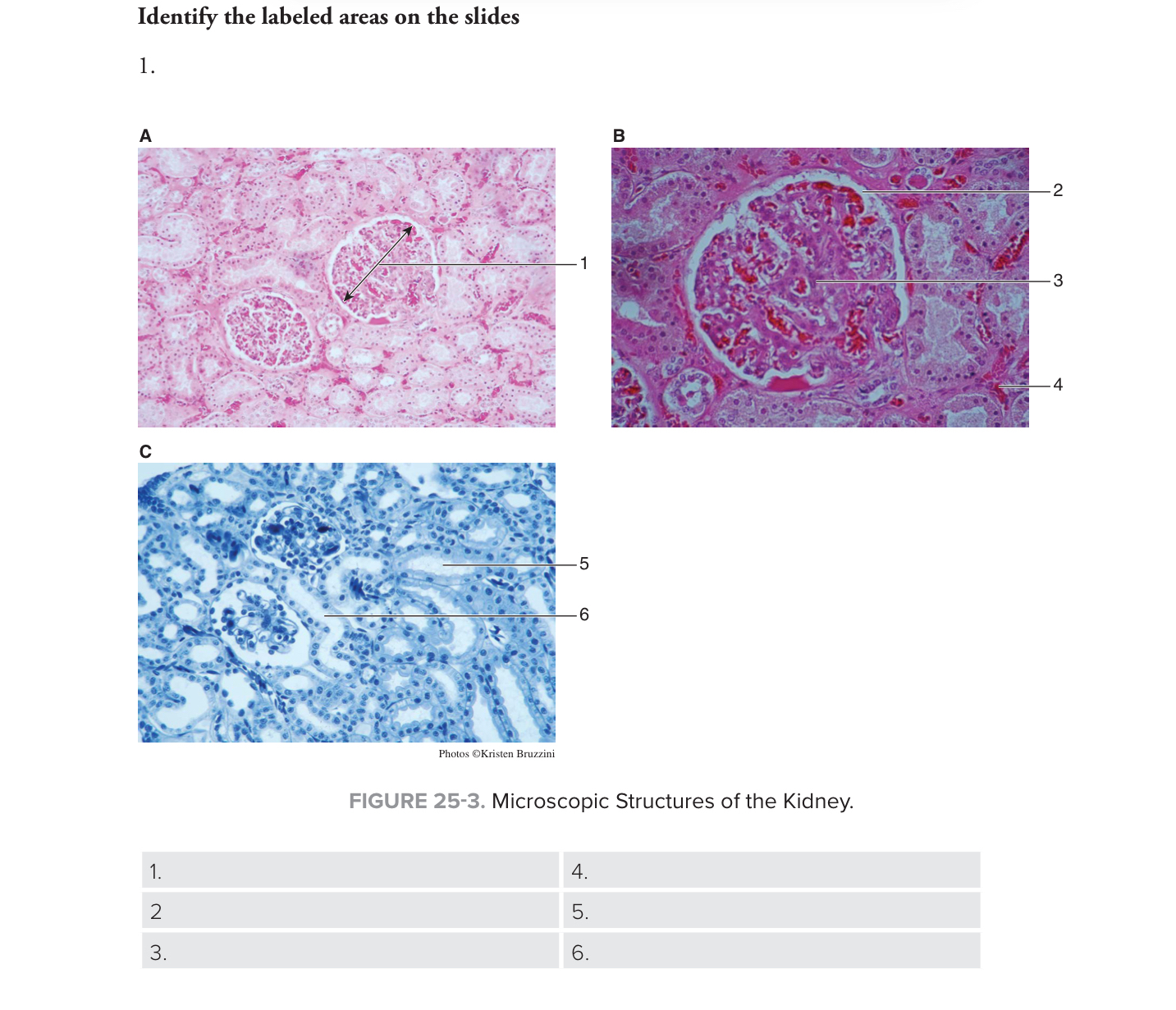Solved Identify the labeled areas on the slides1.CFIGURE | Chegg.com