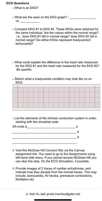 Solved See Figures below for EKG #1 and EKG #2. 1. Label the | Chegg.com