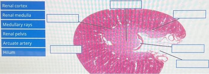 Solved Renal cortex Renal medulla Medullary rays Renal | Chegg.com