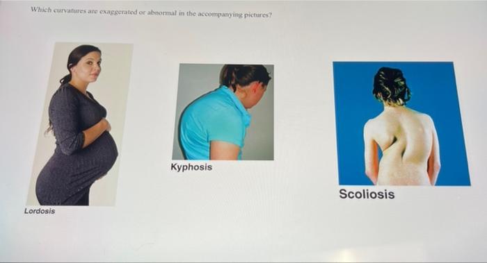 Solved Which curvatures are exaggerated or abnormal in the | Chegg.com