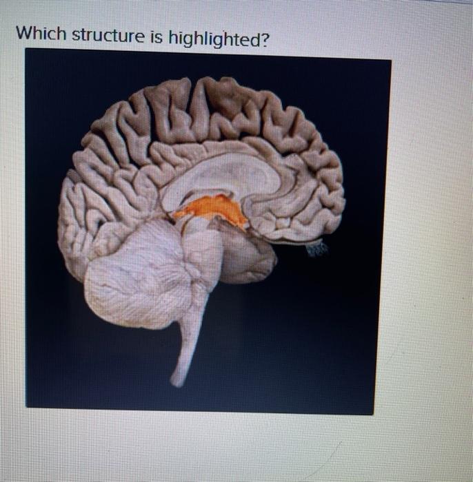 Solved Which structure is highlighted? | Chegg.com