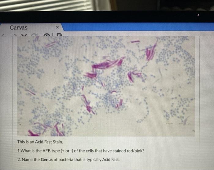 Solved Canvas х V This is an Acid Fast Stain. 1. What is the | Chegg.com