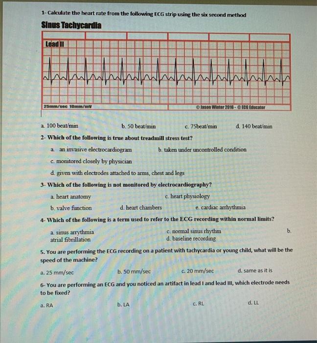 Solved 1- Calculate the heart rate from the following ECG | Chegg.com