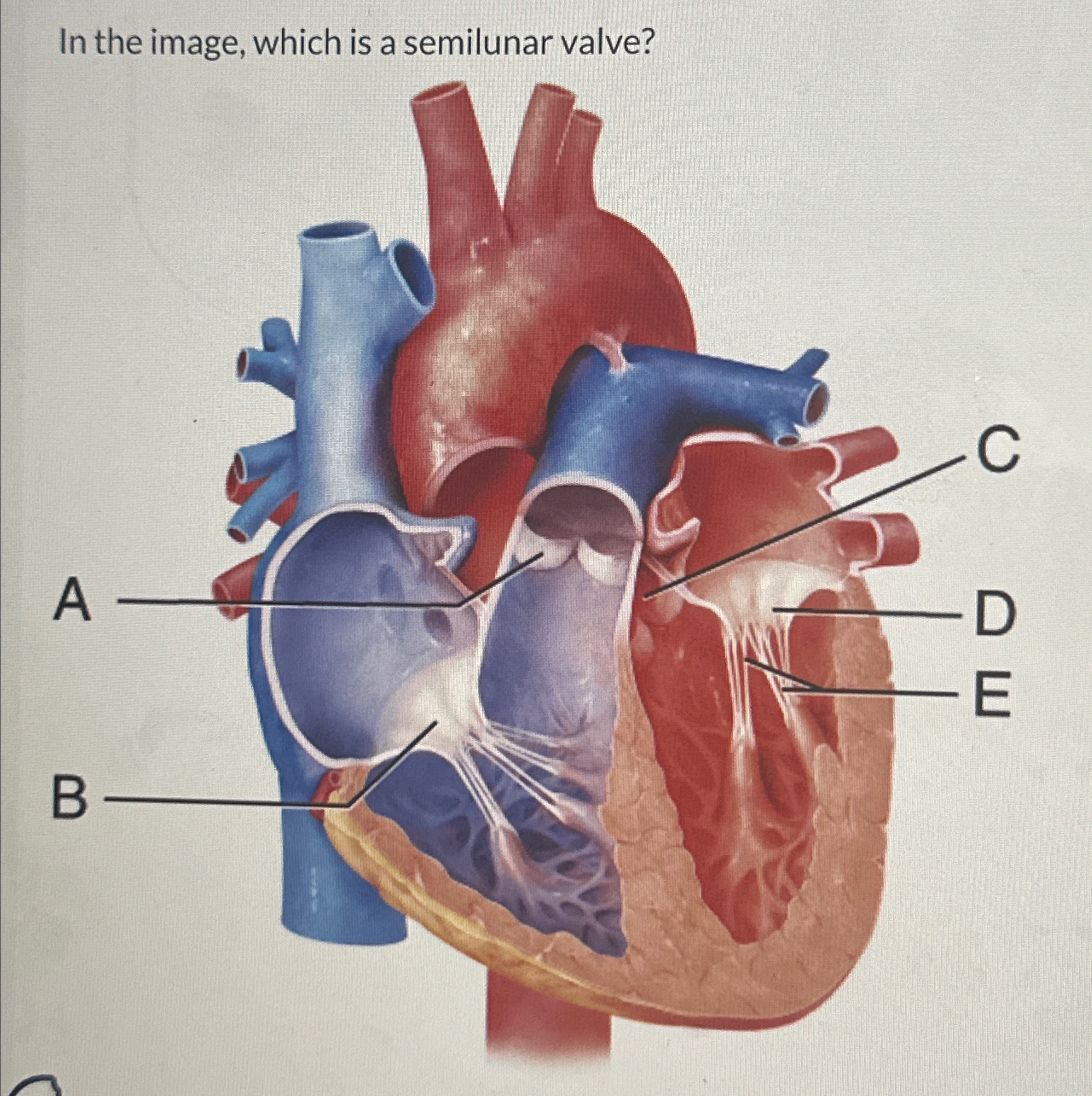 Solved In the image, which is a semilunar valve? | Chegg.com