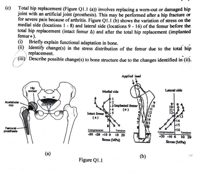 c) Total hip replacement (Figure Q1.1 (a)) involves | Chegg.com