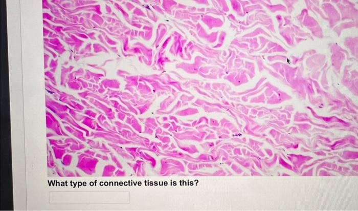 What type of connective tissue is this? QUESTION 33 | Chegg.com