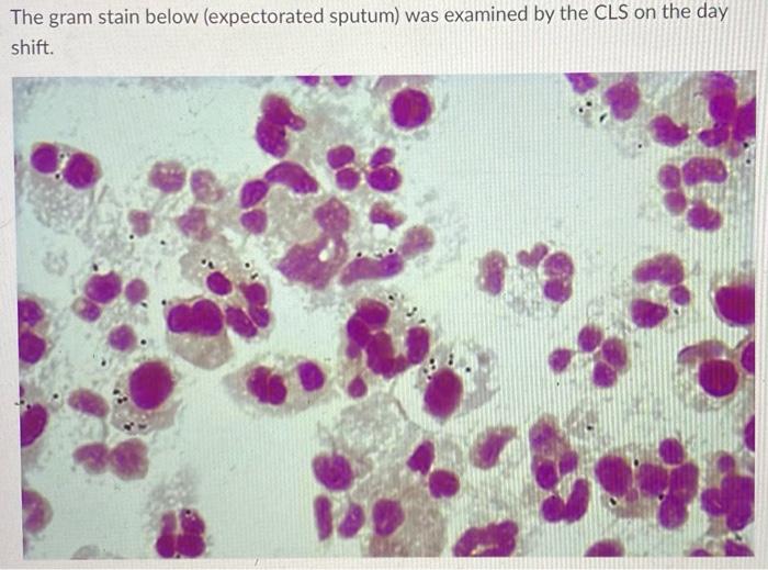 Solved The gram stain below (expectorated sputum) was | Chegg.com