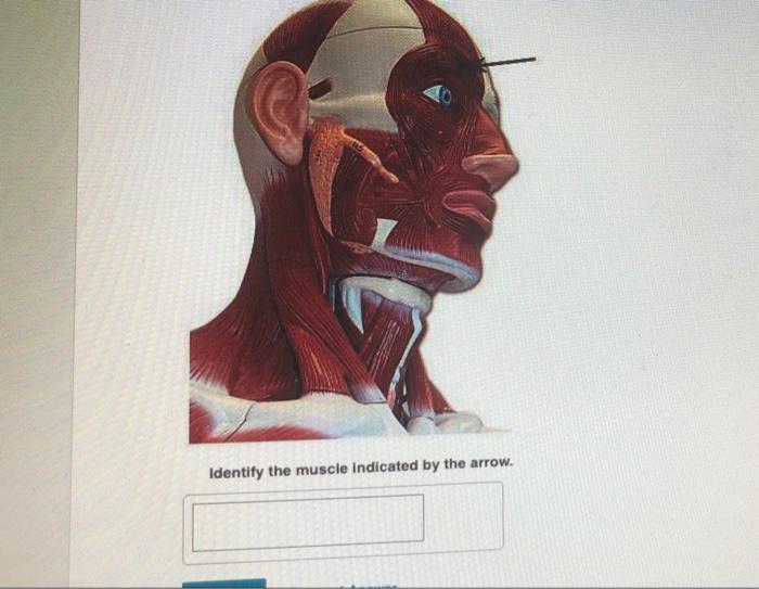 Solved Identify the muscle indicated by the arrow. | Chegg.com