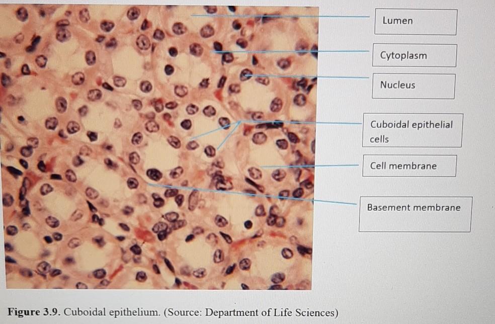 Solved only annotate the cuboidal epithelial cells, lumen | Chegg.com
