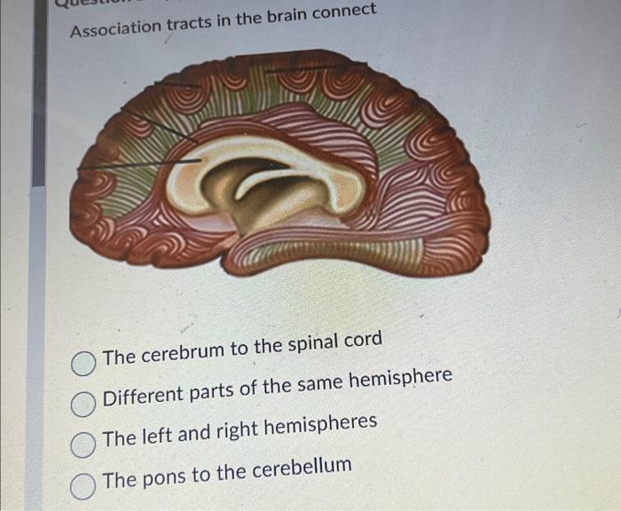 Solved Question 6 (1 point) In the diagram below the tract | Chegg.com