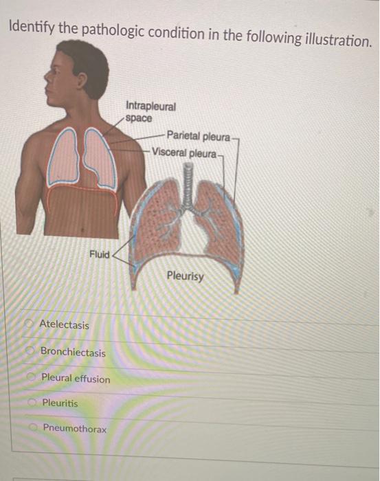 Solved Identify the pathologic condition in the following | Chegg.com