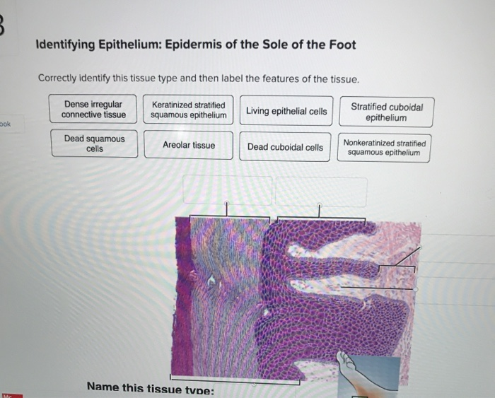 Solved 3 Identifying Epithelium: Epidermis of the Sole of | Chegg.com