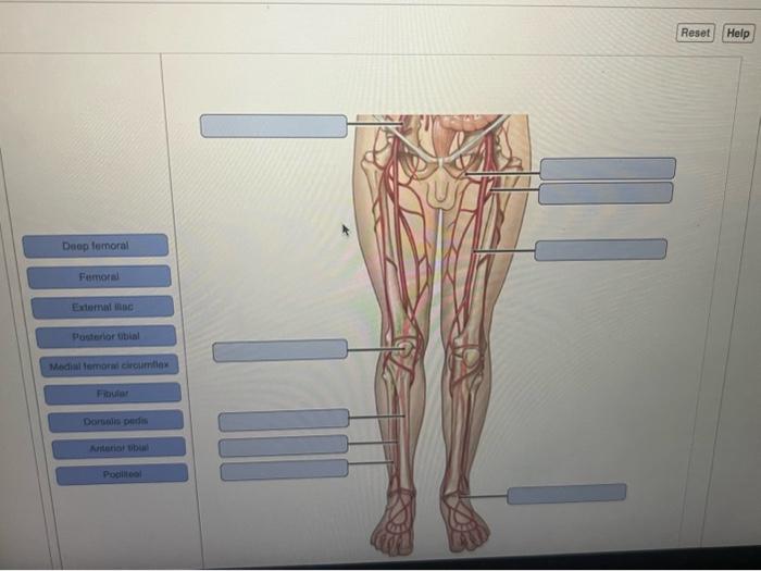 Solved PAL: Models > Cardiovascular System - Arteries > Lab | Chegg.com