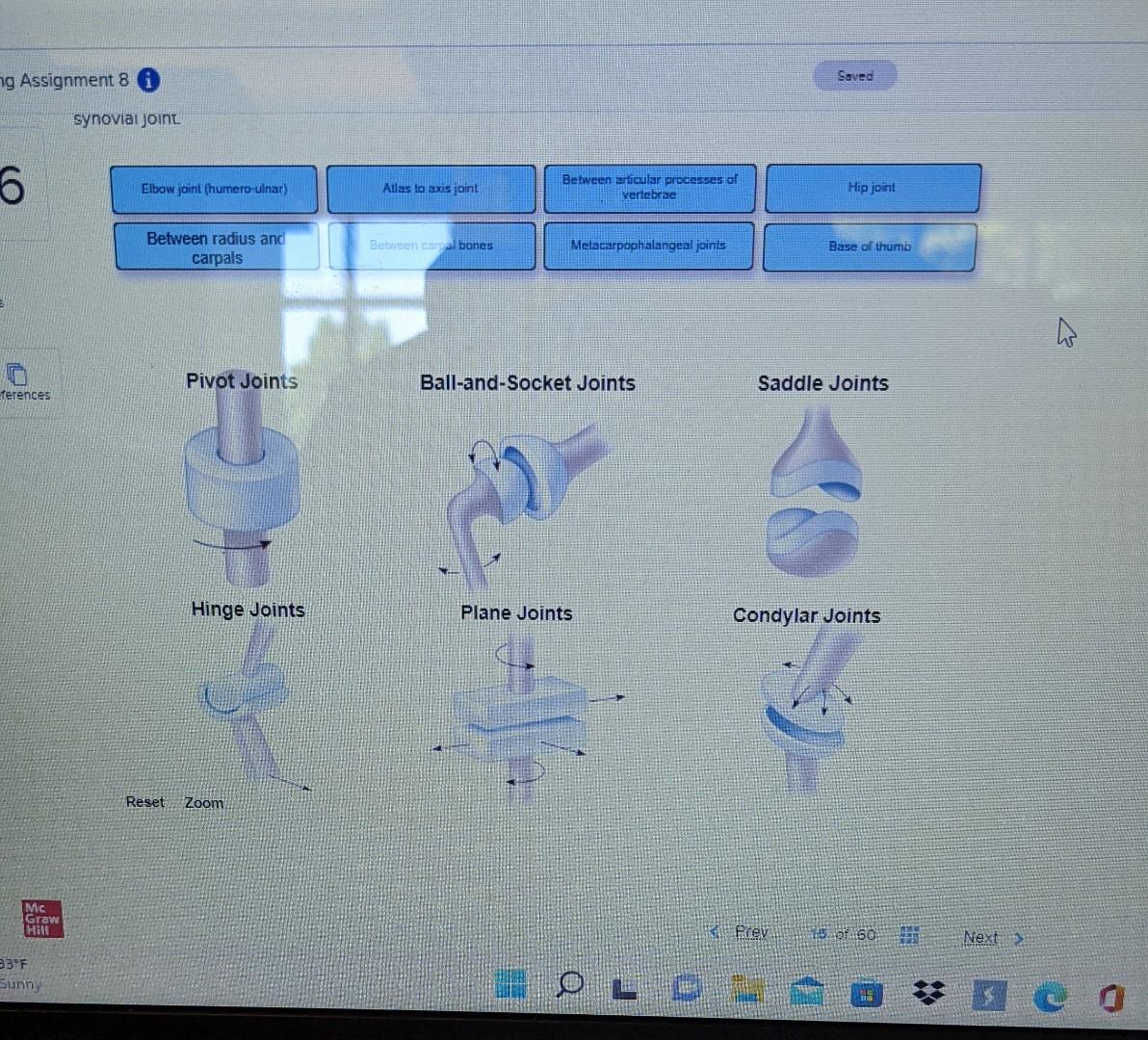 Solved Soved synoviaijoint. | Chegg.com
