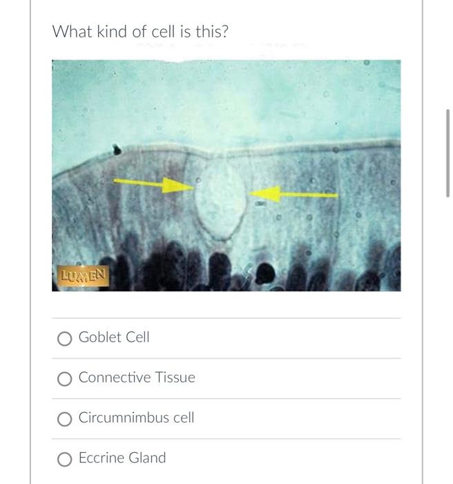 Solved What type of tissue is highlighted in blue? Simple | Chegg.com