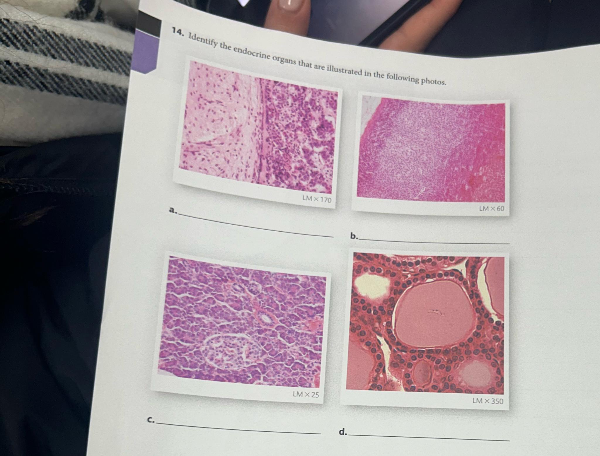 Solved Identify the endocrine organs that are illustrated in | Chegg.com