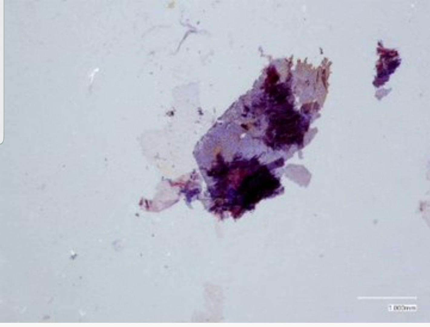 Solved Analyse and interpret the below samples stained | Chegg.com