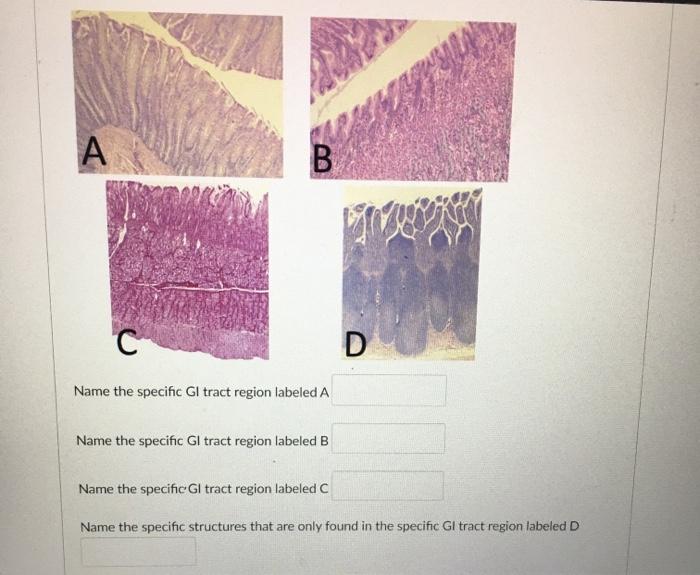 Solved A B С D Name the specific GI tract region labeled A | Chegg.com