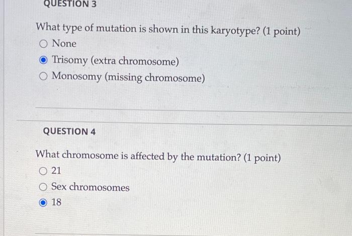 Solved Now You Will Examine A Karyotype And Determine What 9913