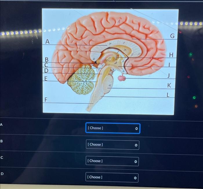 Solved [Choose] B [Choose] [Choose] [Choose] | Chegg.com