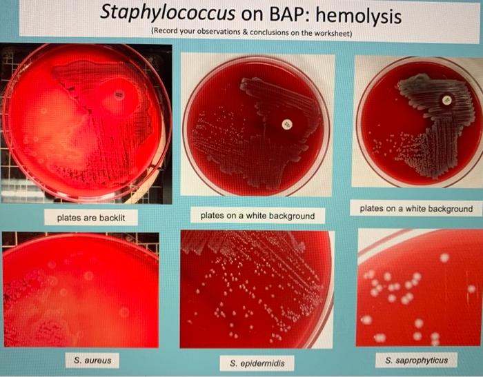 Solved Staphylococcus Demo Gram-positive cocci in irregular | Chegg.com