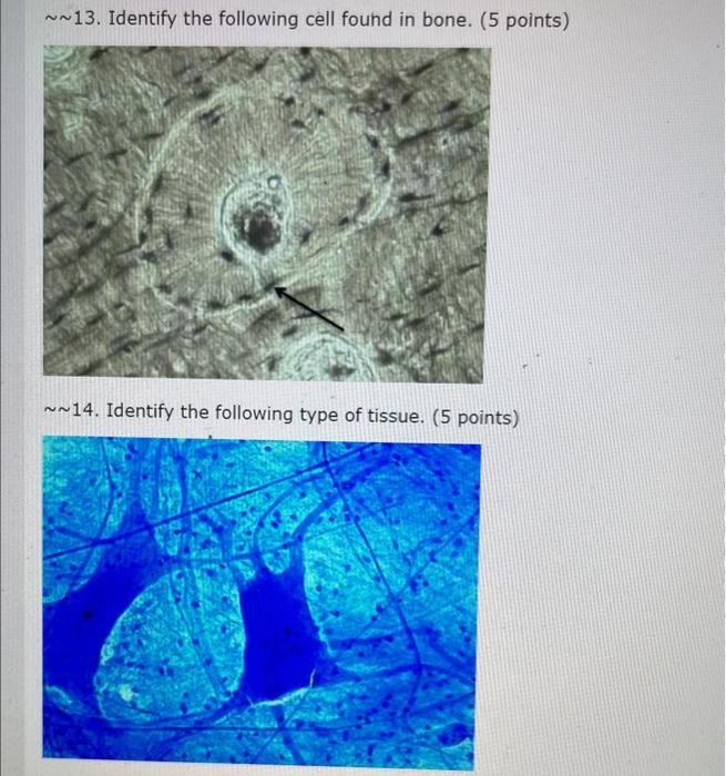 Solved ∼∼5. Name the following type of epithelial tissue. (5 | Chegg.com