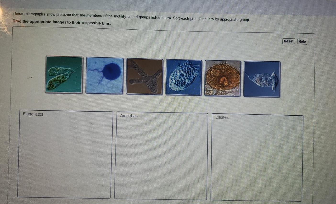 Solved These micrographs show protozoa that are members of | Chegg.com Solved These micrographs show protozoa that are members of | Chegg.com
