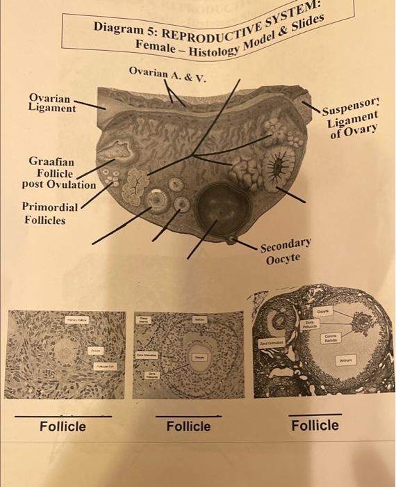 Ovary Slide Labeled Graafian Follicle