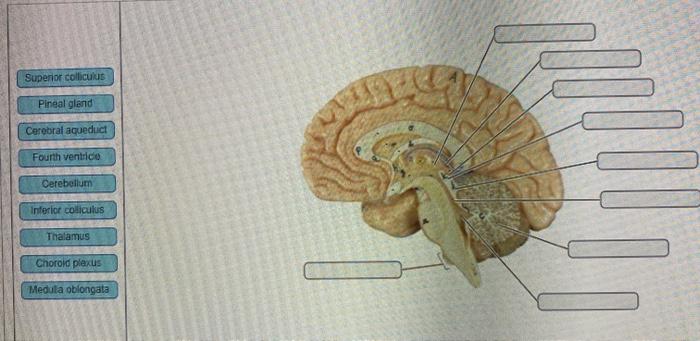 Solved Hypothalamus Interthalamic adhesion Anterior | Chegg.com