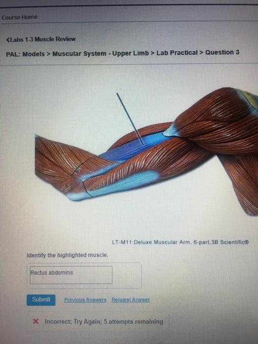 Solved Course Home Muscular System - Upper Limb > Lab | Chegg.com