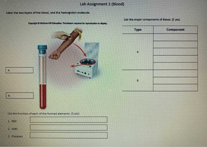 Lab Assignment 2 (Blood) Label the two layers of the | Chegg.com