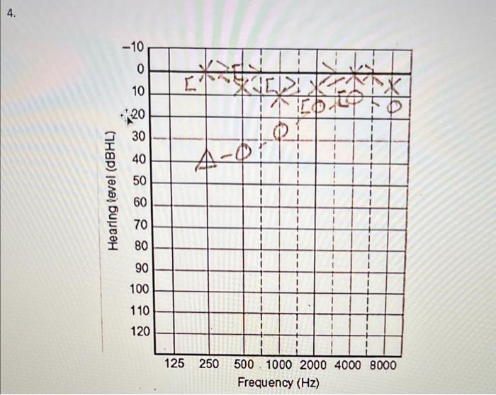 Solved Interpret the audiograms below and calculate the pure | Chegg.com
