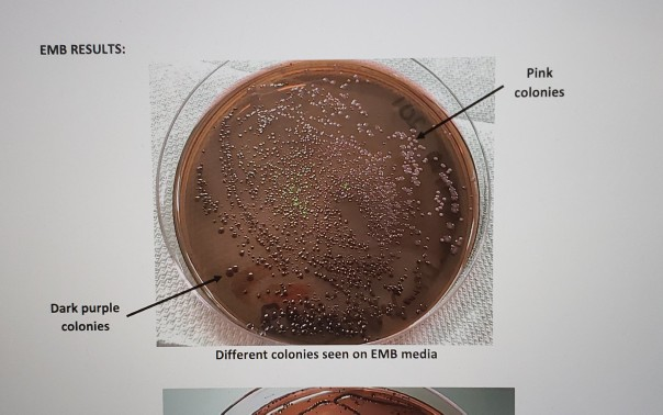 Solved EMB RESULTS: Pink colonies Dark purple colonies | Chegg.com