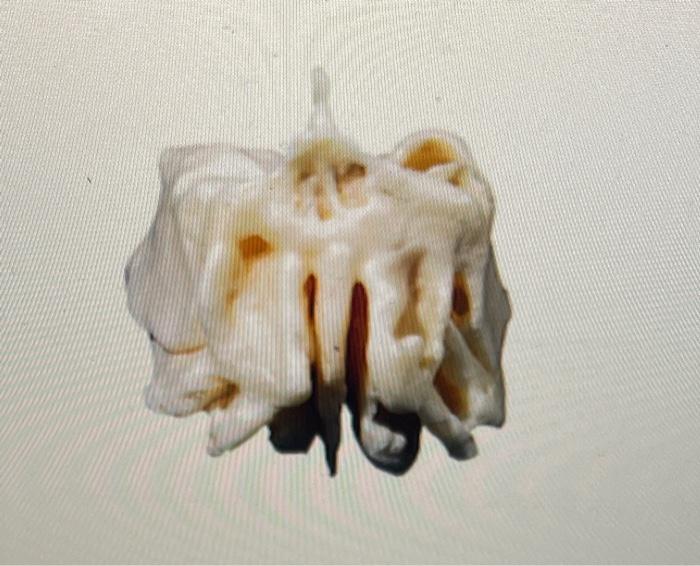 Solved Identify the bones | Chegg.com