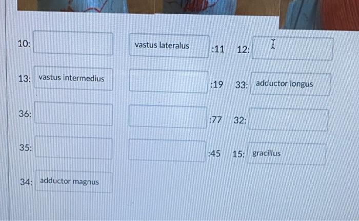 Solved Question 6 Muscles of lower extremity - Identify the | Chegg.com