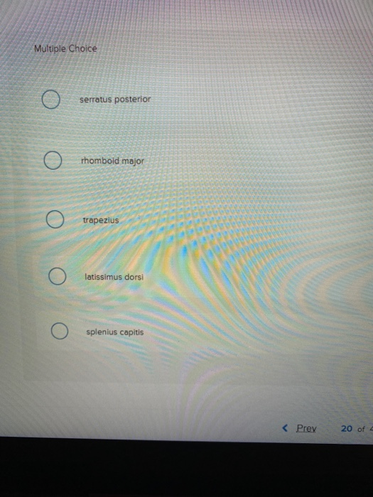 Solved iz: Muscular System Which structure is highlighted? | Chegg.com