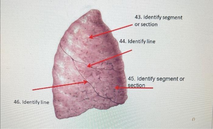 Solved 43. Identify segment or section 44. Identify line 45. | Chegg.com
