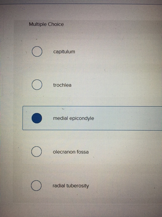 Solved Which structure is highlighted? Multiple Choice O | Chegg.com