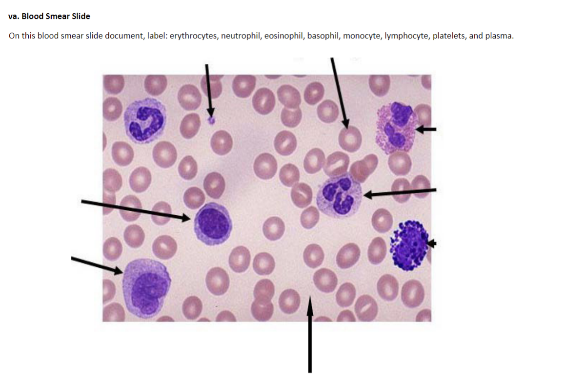 Solved va. ﻿Blood Smear SlideOn this blood smear slide | Chegg.com