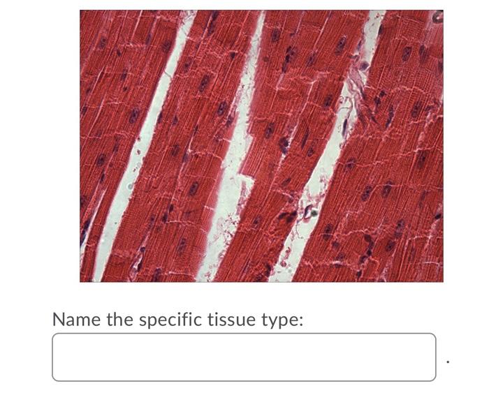 Solved 1. General tissue type: EPITHELIAL Specific tissue | Chegg.com