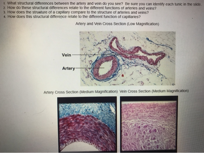Solved 1. What structural differences between the artery and | Chegg.com