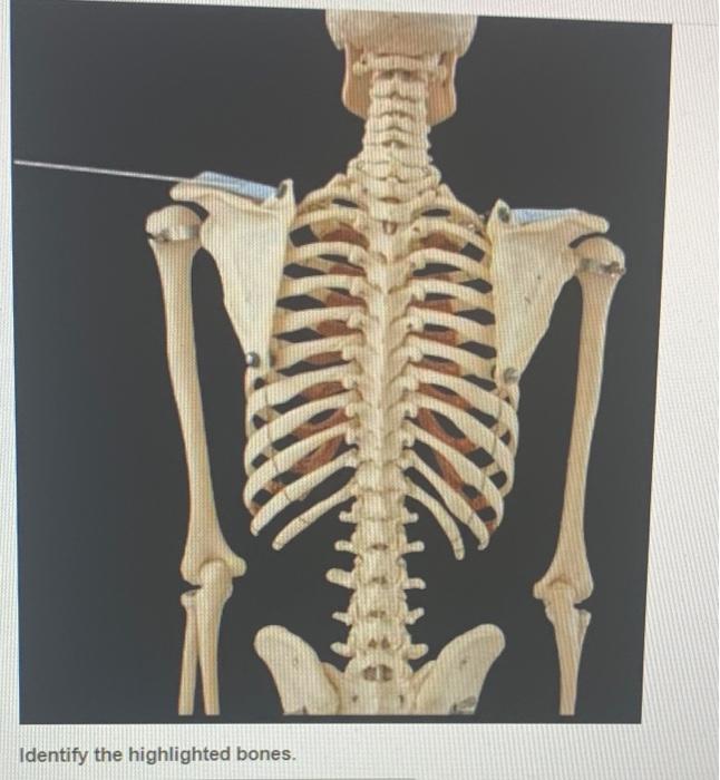 Solved Identify the highlighted structures. Name the type | Chegg.com