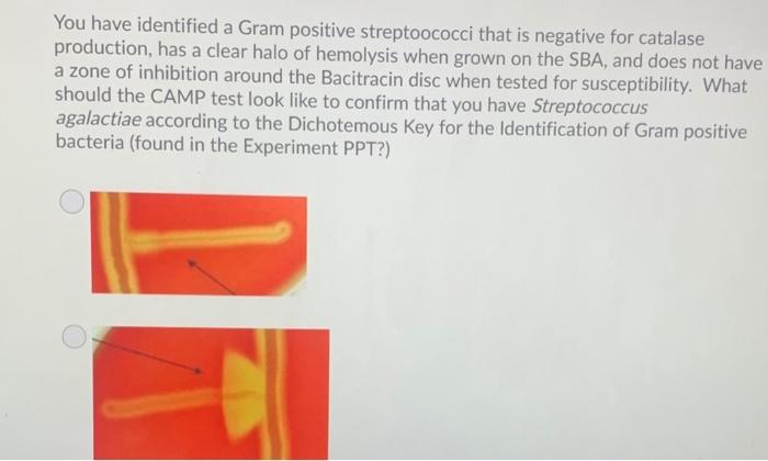 Solved You have identified a Gram positive streptoococci | Chegg.com