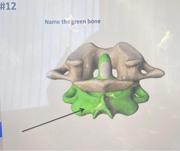 Solved #12 Name the green bone | Chegg.com