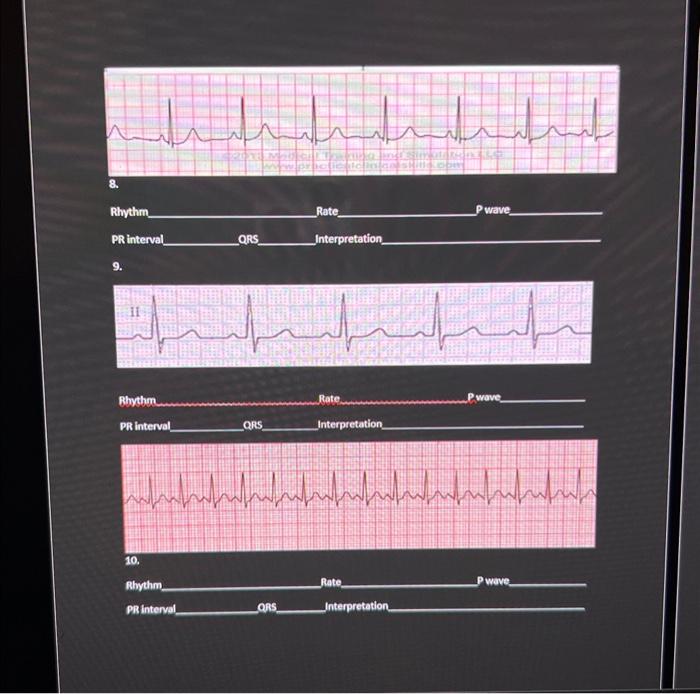 Solved Rhythm Rate P wave PR interval QRS Interpretation. 9. | Chegg.com