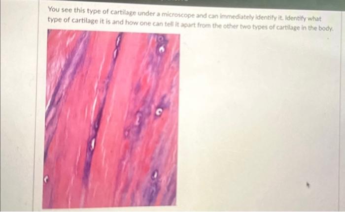 hyaline cartilage due to the collagen fibers that | Chegg.com