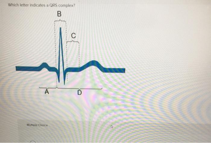 Solved Which letter indicates a QRS complex? B C A D | Chegg.com