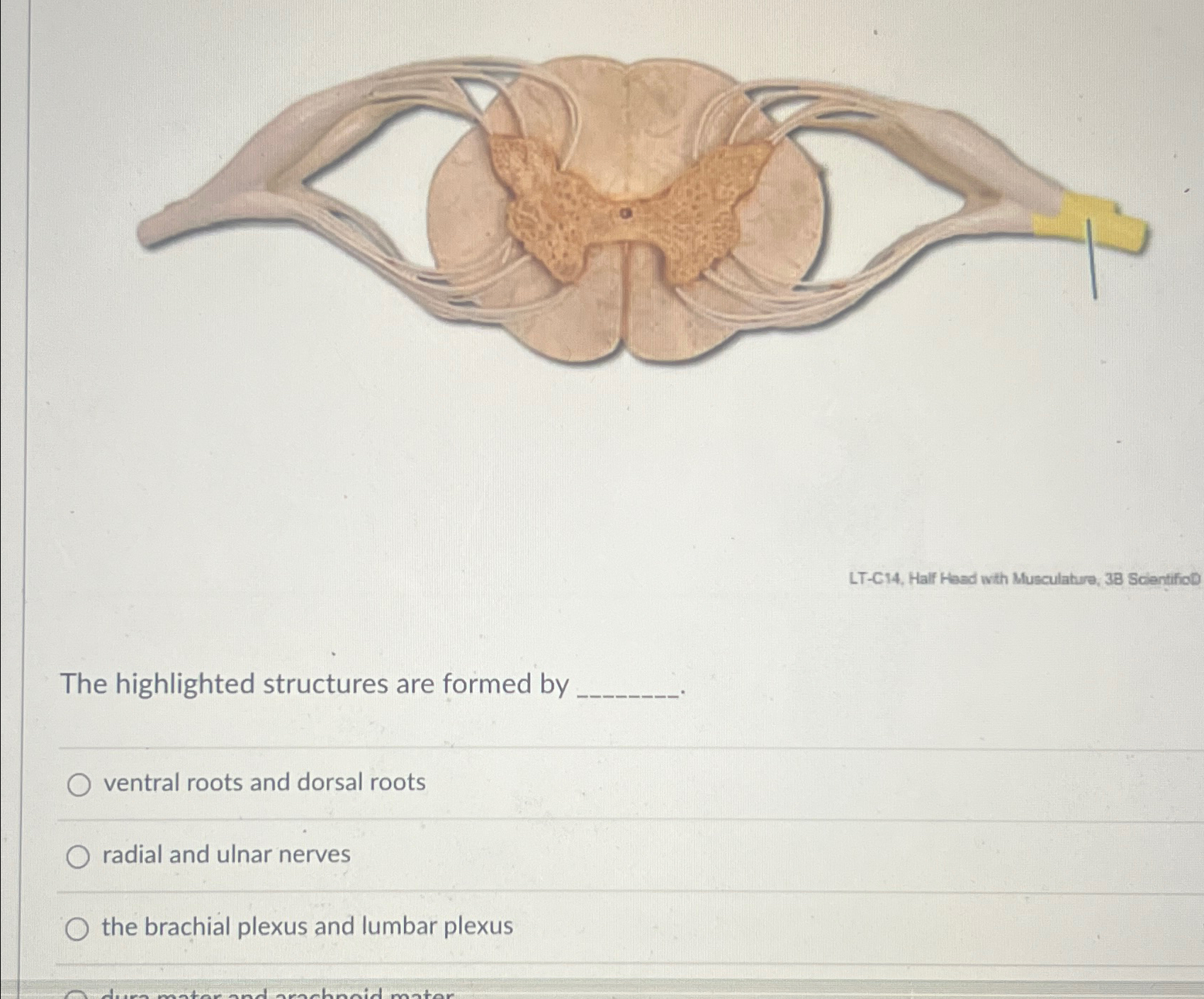 Solved LT-C14, ﻿Half Head wth Musculahure, 38 | Chegg.com