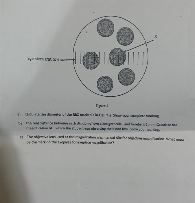 Solved Magnification and Micrometry (Practical exercise) The | Chegg.com