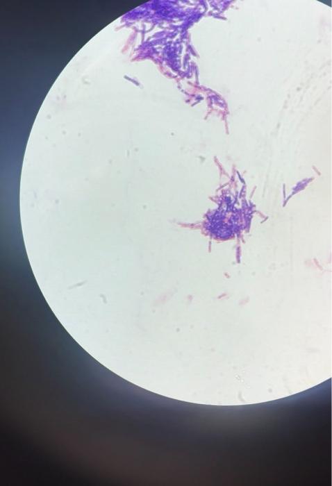 Solved any ideas on what my unknown bacteria looks like ? im | Chegg.com